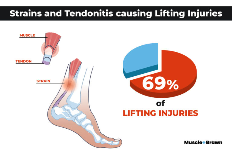 14 Lifting Injury Statistics (Bodybuilding And Weights)