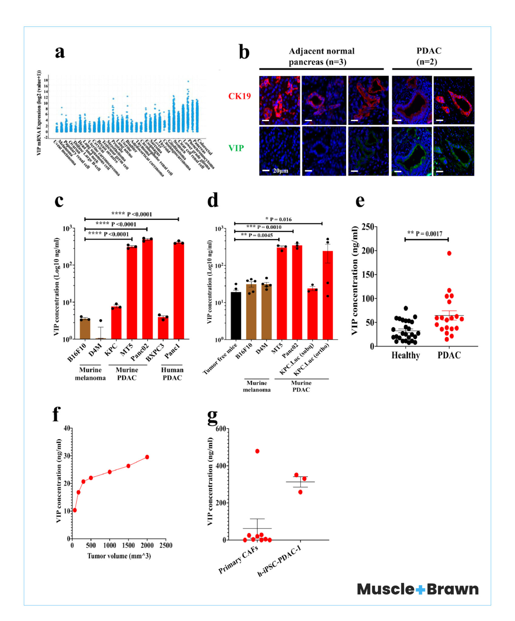 Vasoactive Intestinal Peptide (VIP) Guide