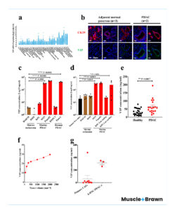 Vasoactive Intestinal Peptide (VIP) Guide