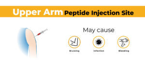 Peptide Injection Sites - Full Guide On Where To Inject Peptides
