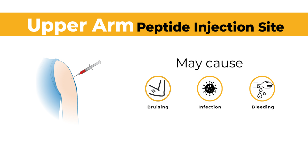 Peptide Injection Sites - Full Guide On Where To Inject Peptides