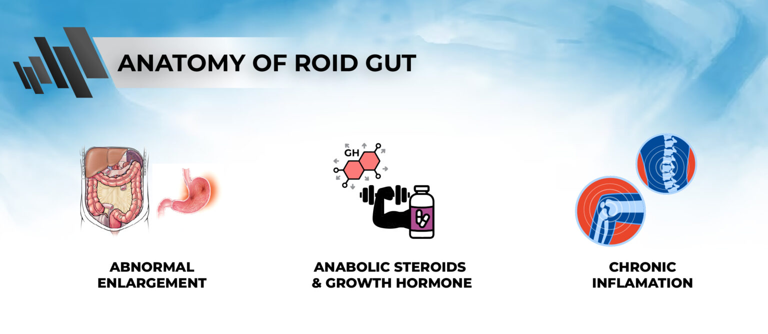 Roid Gut Revealed: Understanding Palumboism